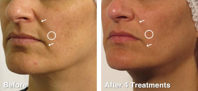 VoluDerm-03 – The Global Beauty Group